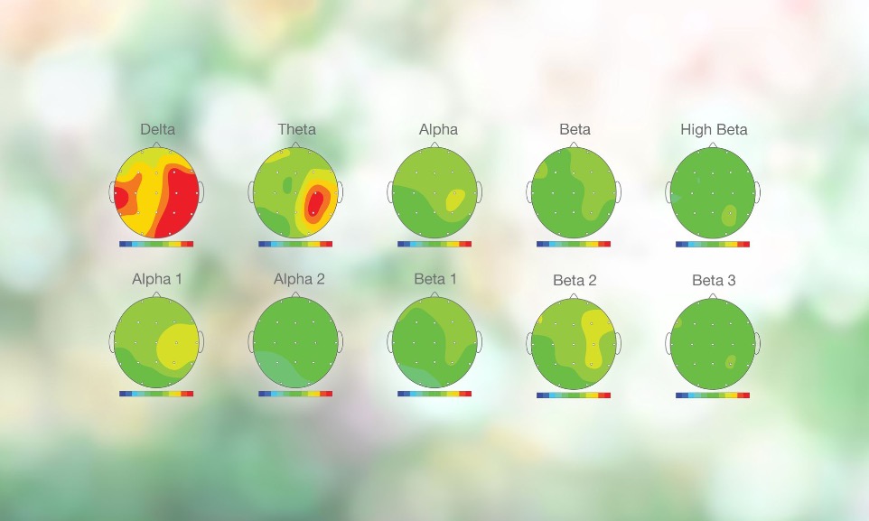 Rewire your brain through brain-maps based neurofeedback